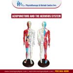 Acupuncture: Natural Stress Relief and How It Works Explained