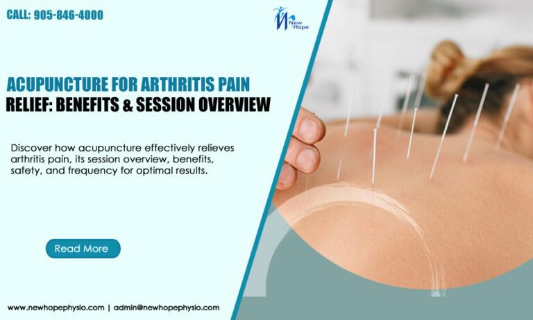 Acupuncture for Arthritis Pain Relief: Benefits & Session Overview