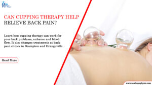 Effective Cupping Therapy Techniques for Treating Back Pain